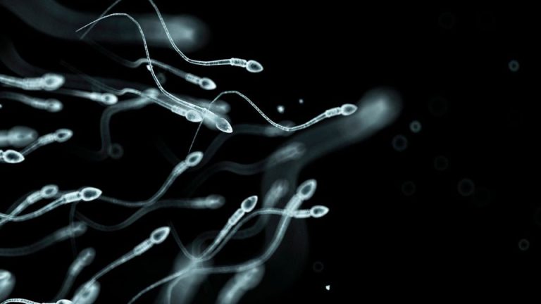 Low Sperm Motility - Its Causes, Treatment & More