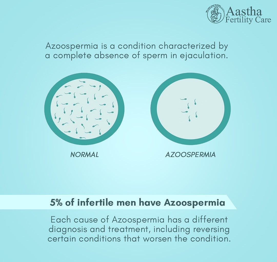 What is Azoospermia (No sperm count): Causes & Treatment