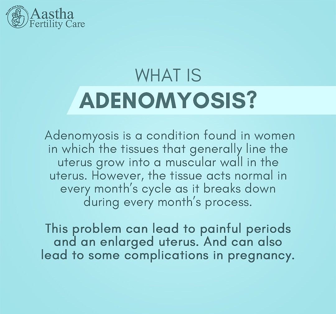 Adenomyosis Symptoms, Causes, And Treatment